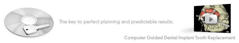 NobelGuide and i-CAT Chicago Illinois, ORA Oral Surgery & Implant Studio