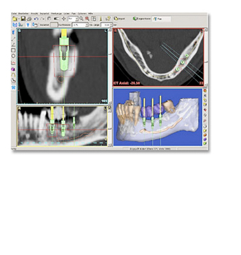 NobelGuide and i-CAT Chicago Illinois, ORA ® Oral Surgery & Implant Studio